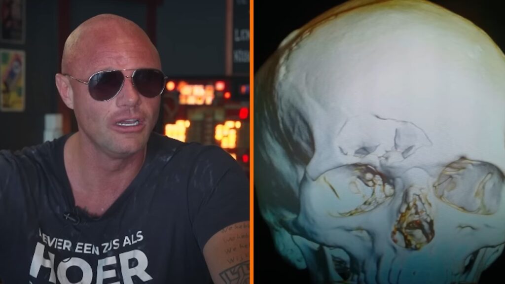 Alex Soze doet openhartige bekentenissen in nieuwe documentaire over ...