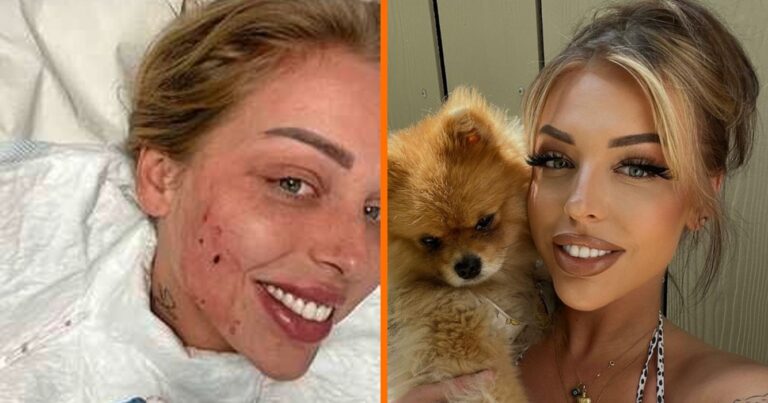 Ingreep Shirley Cramer gaat fout 'Spoot bloed uit mijn wang'