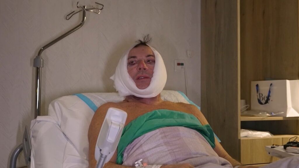 Gerard Joling ondergaat opnieuw ingrijpende facelift